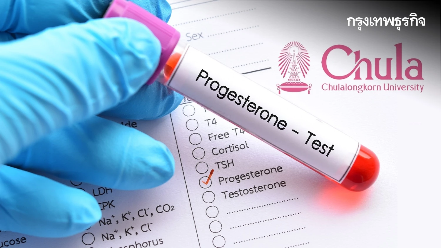 "Progesterone Test Kit" นวัตกรรมนักวิจัยจุฬาฯ ช่วยหมูสาวสู่วัยเจริญพันธุ์