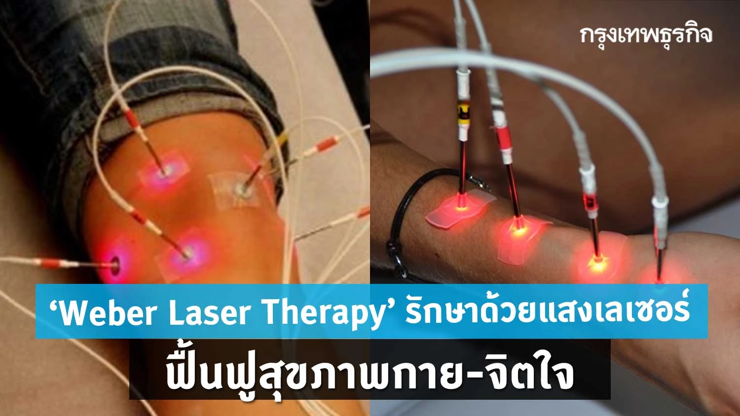 ‘Weber Laser Therapy’ การรักษาด้วยแสงเลเซอร์ครบวงจร ฟื้นฟูสุขภาพกาย-จิตใจ